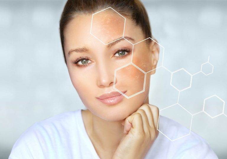 Understanding Skin Redness: Causes, the Skin Microbiome and Solutions ...